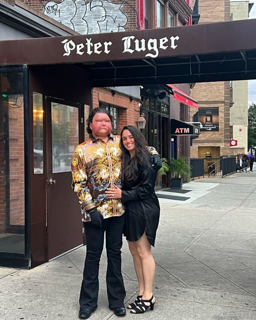 NJ face transplant recipient, fiancee post engagement photos: ‘So ...