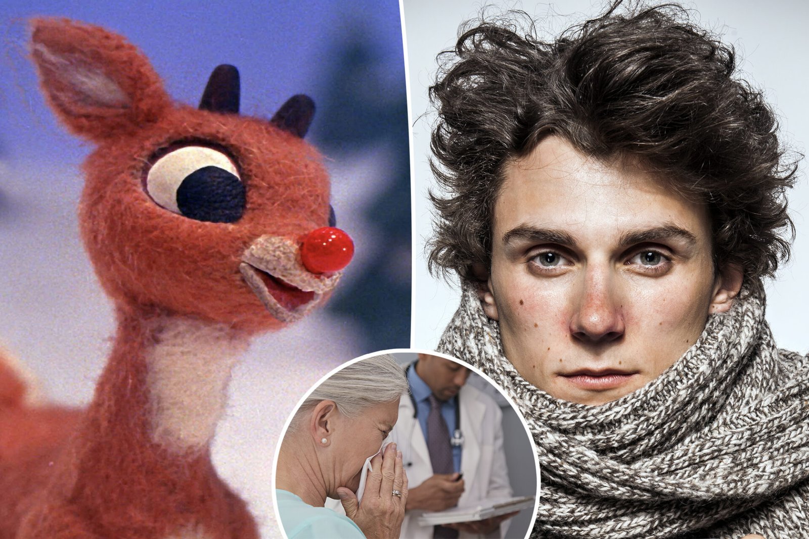 Red-nosed ‘Rudolph Sign’ is a hint you have this nasal infection — it’s ...