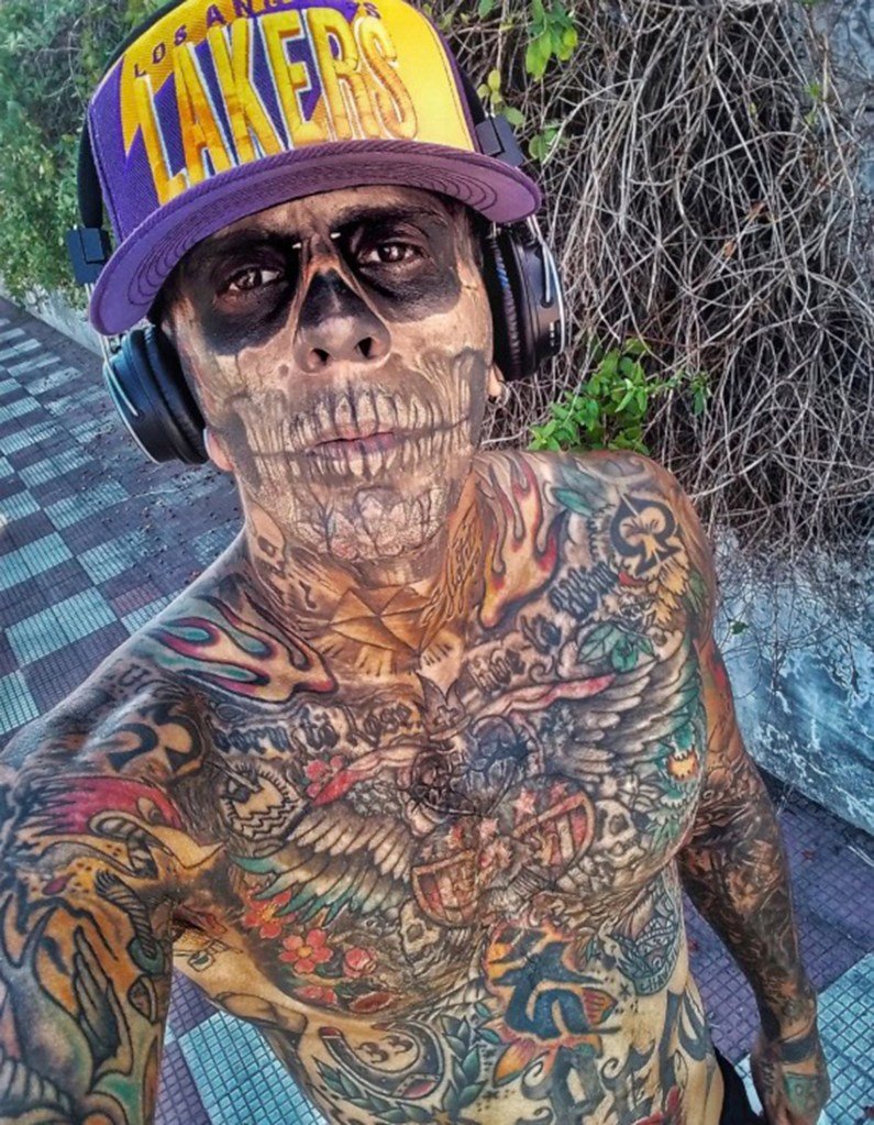 I had tattoos on 95% of my body — now I’m having them removed, and the ...