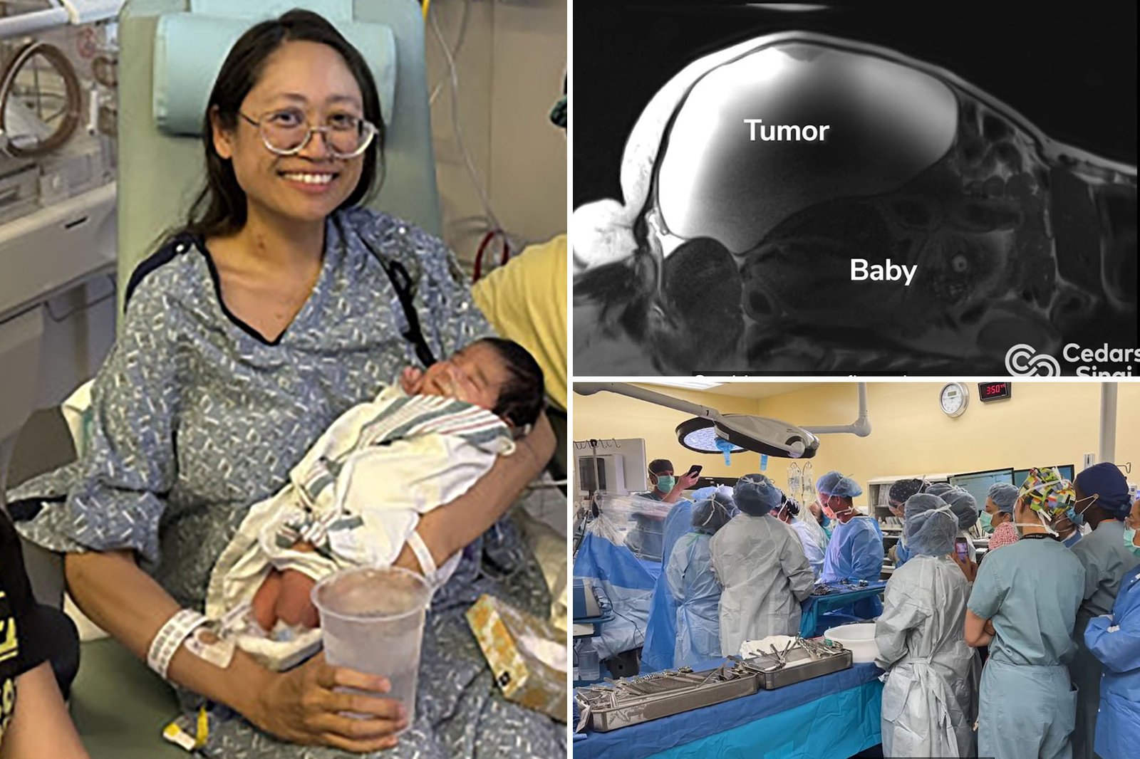 Doctors deliver ‘miracle’ baby while removing 22-pound tumor from ...